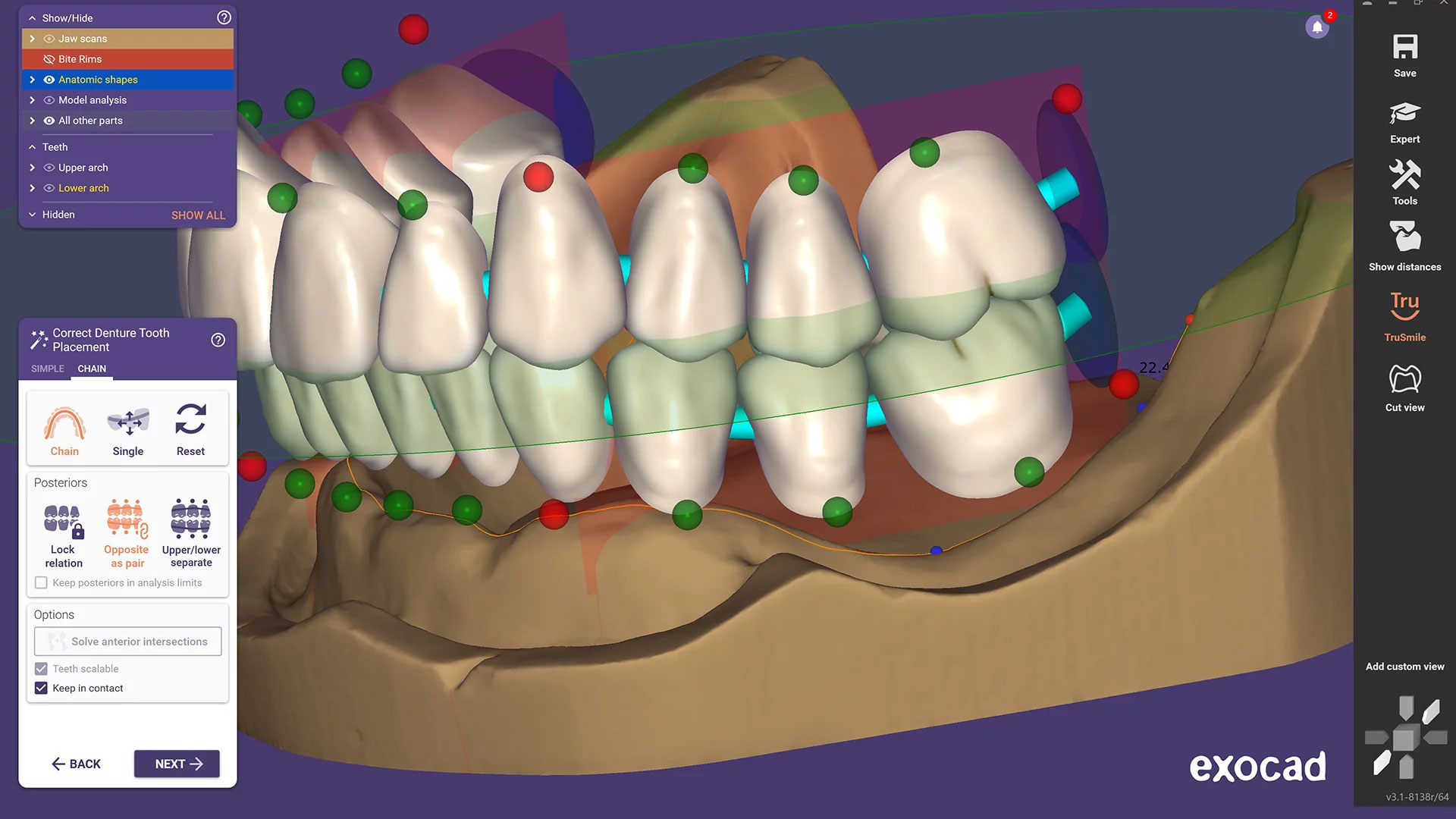 دانلود نرم افزار اگزوکد - دنتال اپ ایران
