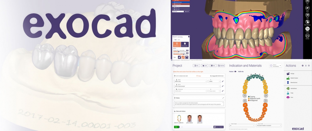 اگزوکد (دنتال کد) - ExoCAD - دنتال اپ ایران