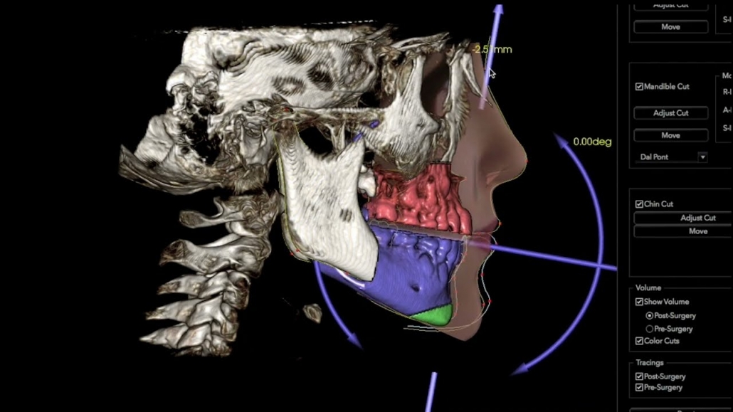 Invivo 7 - دنتال اپ ایران