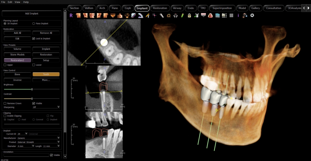 Invivo 7 - دنتال اپ ایران