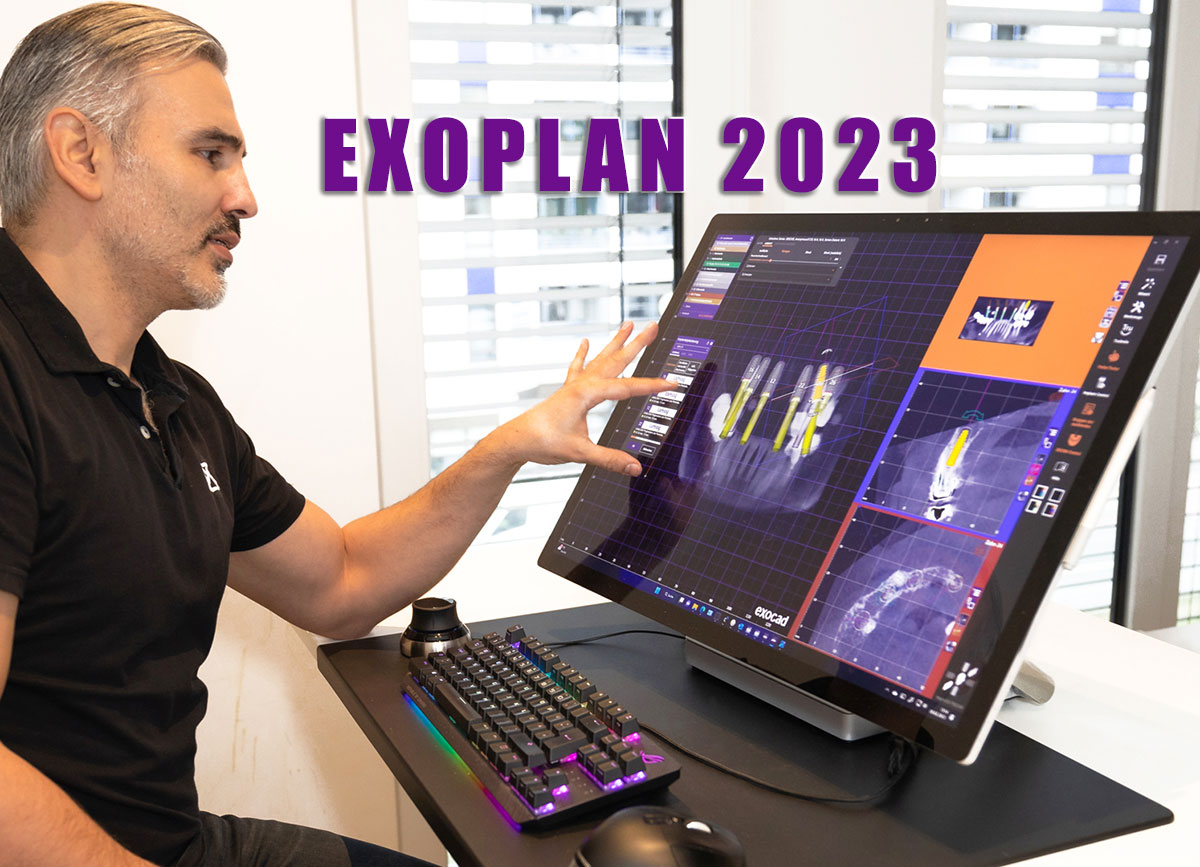 ExoPlan 3.1 - 2023 - دنتال اپ ایران