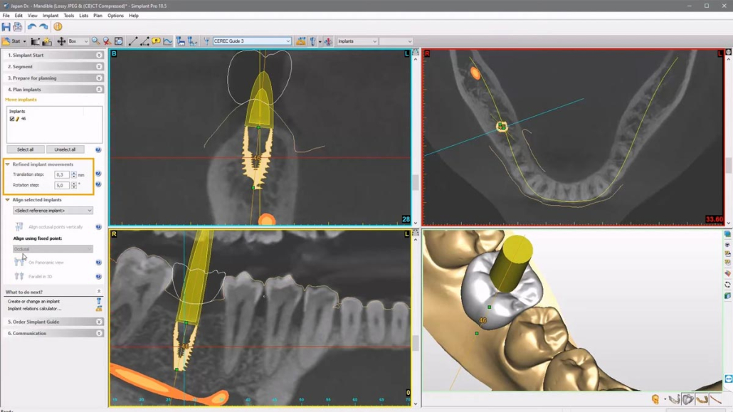 Simplant Pro 17 - دنتال اپ ایران